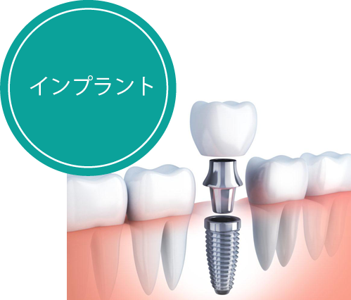 自由診療について-やすらおか歯科